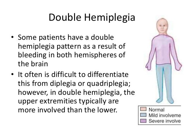 4.cerebral palsy and hydrocephaly