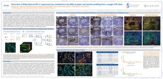 AACR-2016 RNA Scope Poster_040516 | PDF