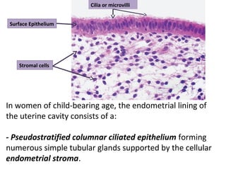 Tumors of the Endometrium | PPT