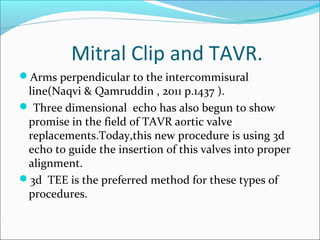Three Dimensional Echocardiography | PPT