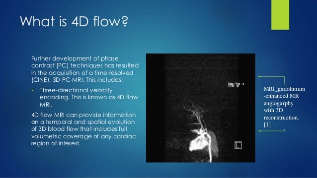 4D Flow MRI