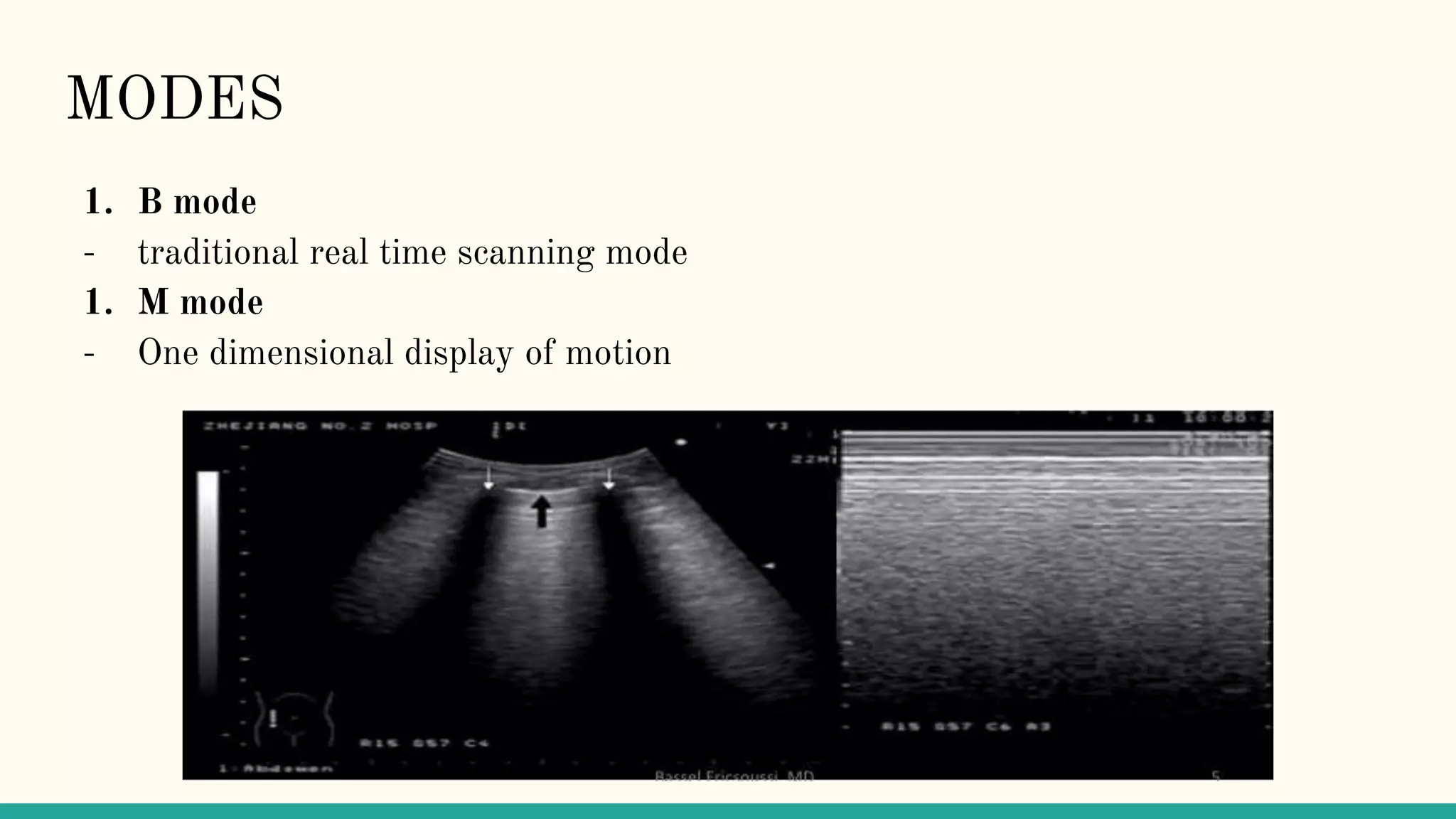 trans thoracic ultrasound of chest | PPTX | Lung and Respiratory Health ...