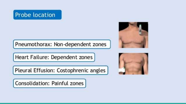 trans thoracic ultrasound of chest | PPTX | Lung and Respiratory Health ...