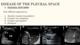trans thoracic ultrasound of chest | PPT