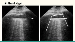 trans thoracic ultrasound of chest | PPT