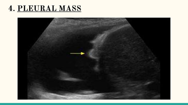 trans thoracic ultrasound of chest | PPTX | Lung and Respiratory Health ...
