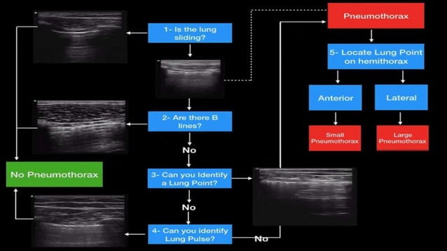 trans thoracic ultrasound of chest | PPTX | Lung and Respiratory Health ...