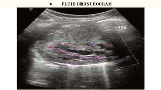 trans thoracic ultrasound of chest | PPT