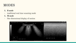 trans thoracic ultrasound of chest | PPT