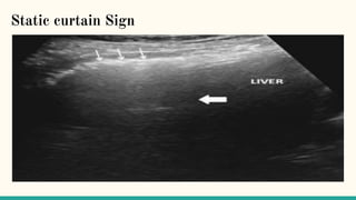 trans thoracic ultrasound of chest | PPT