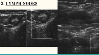 trans thoracic ultrasound of chest | PPT
