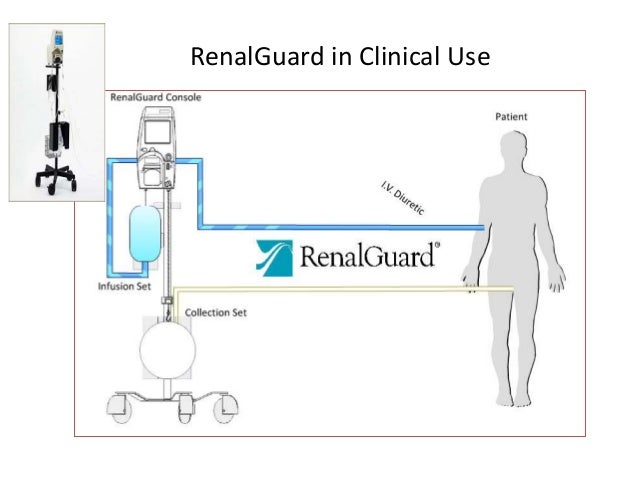 RenalGuard- The kidneys are nowhere near the heart