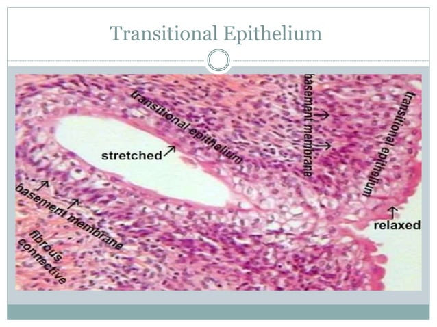 2. epithelial-t[1] | PPT