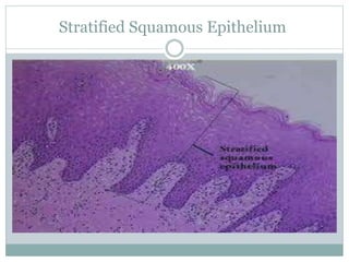 Transitional Epithelium Slide 400x
