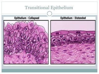 Transitional Epithelium Collapsed