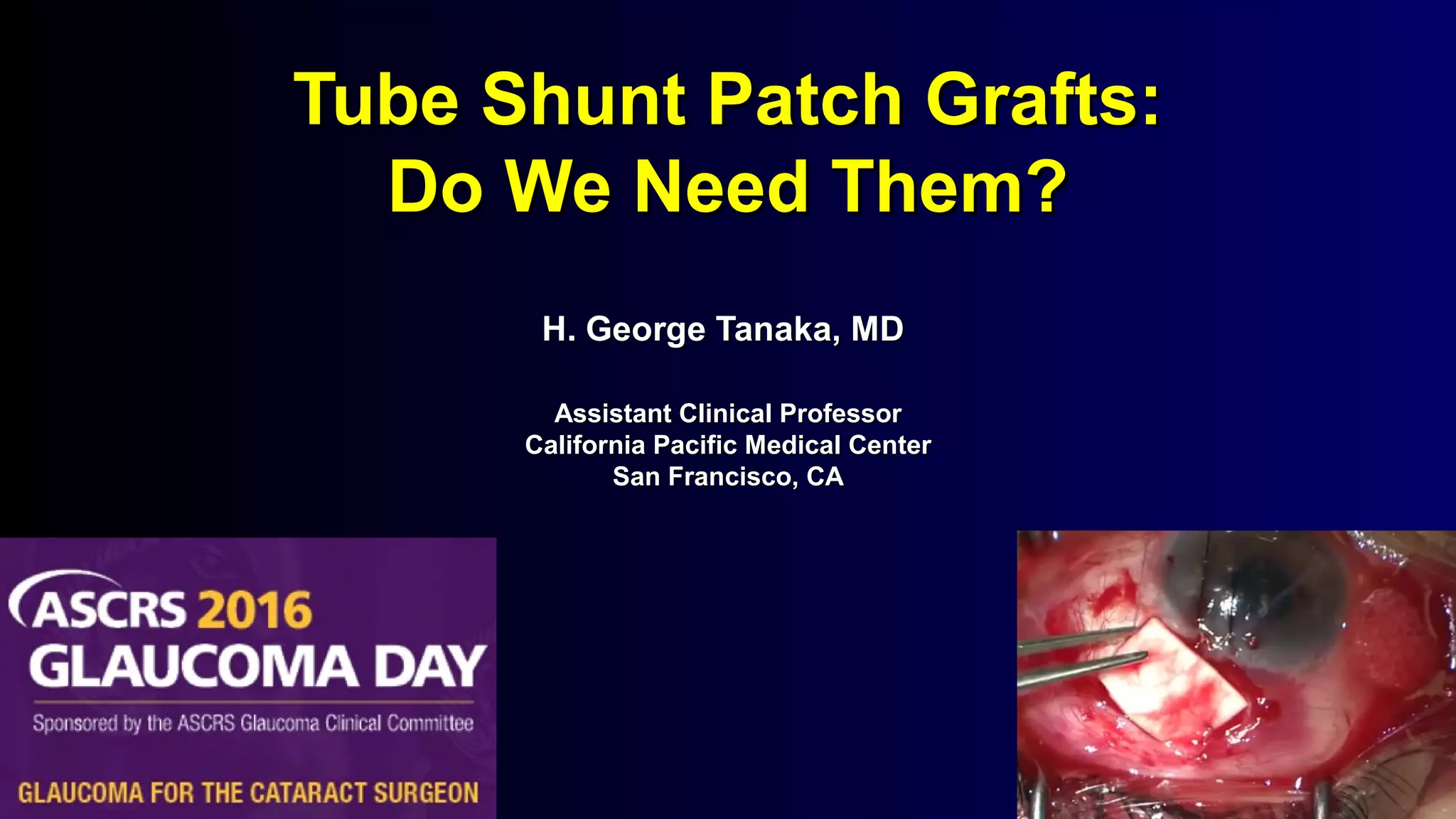 Tanaka Tube Shunt Patch Grafts 2016 | PPT