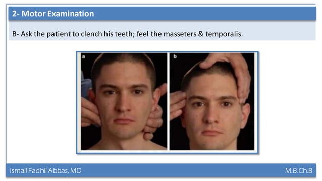 Trigeminal & Facial Nerve Clinically | PPT