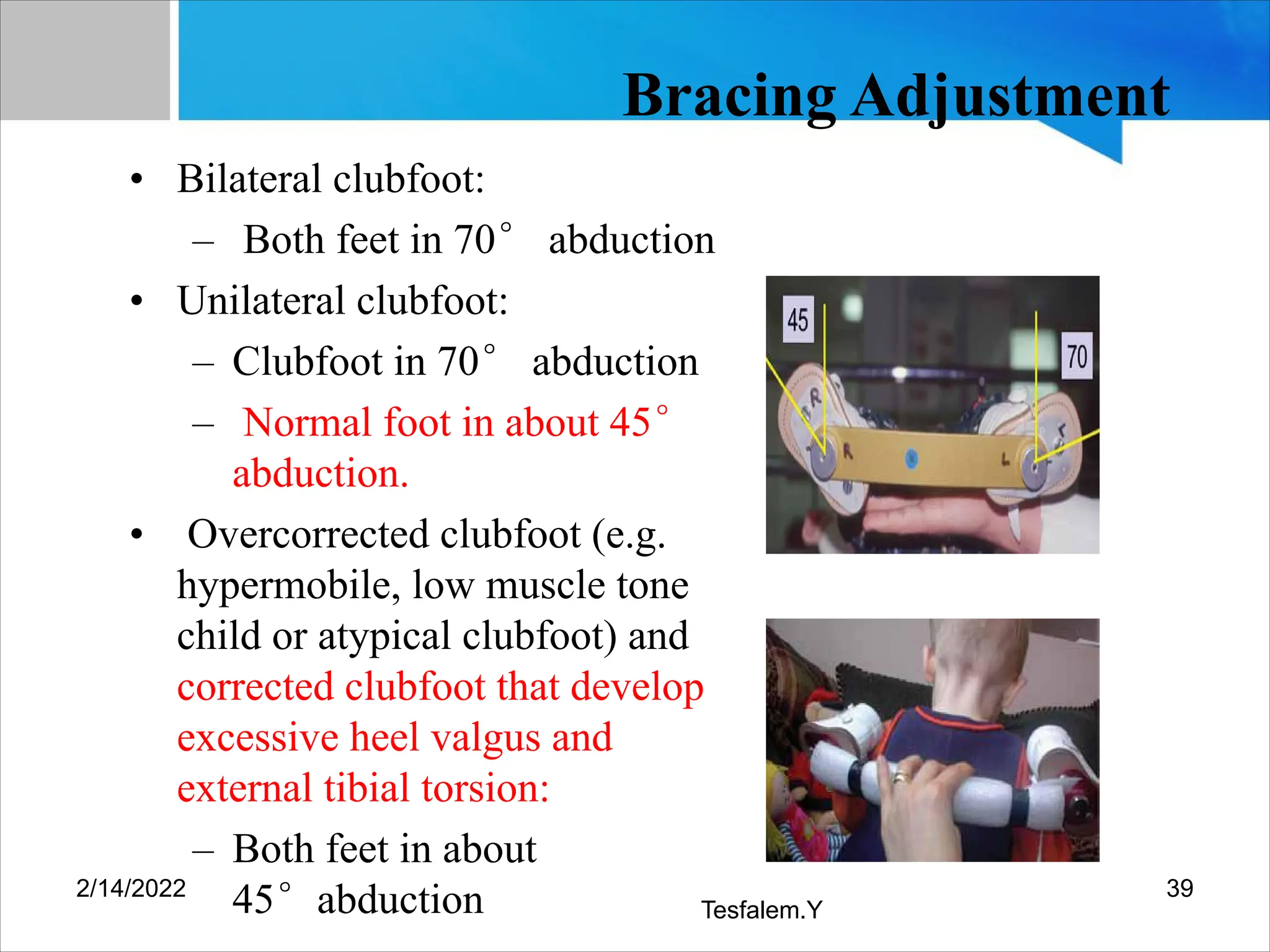 c5 cong.Club foot.pdf