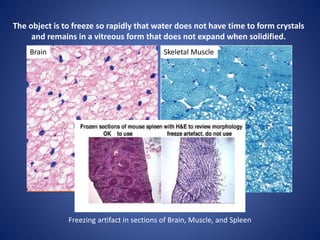 Tissue Freezing Presentation (2) | PPTX