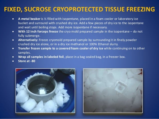 Dry Ice And Ethanol Bath For Flash Freezing Samples – ETKTD