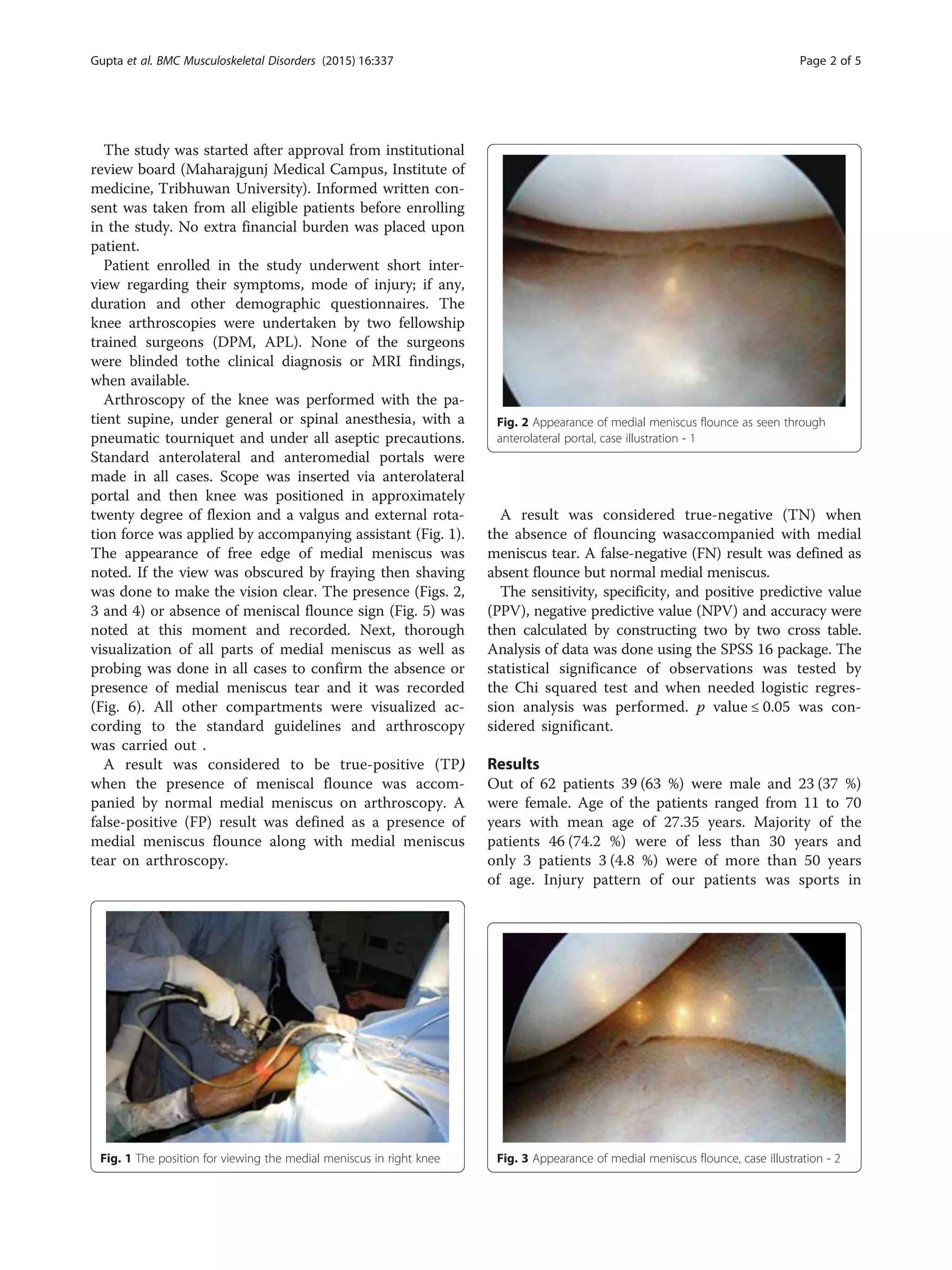 12. Meniscal flounce | PDF