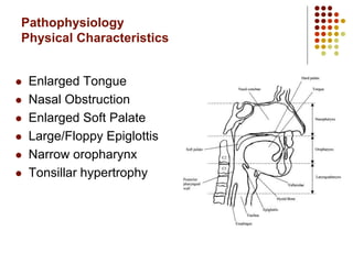 OSA_IN_ADULTS_FINAL | PPT | Free Download
