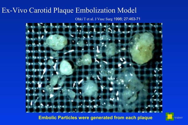 Embolic protection devices | PPT
