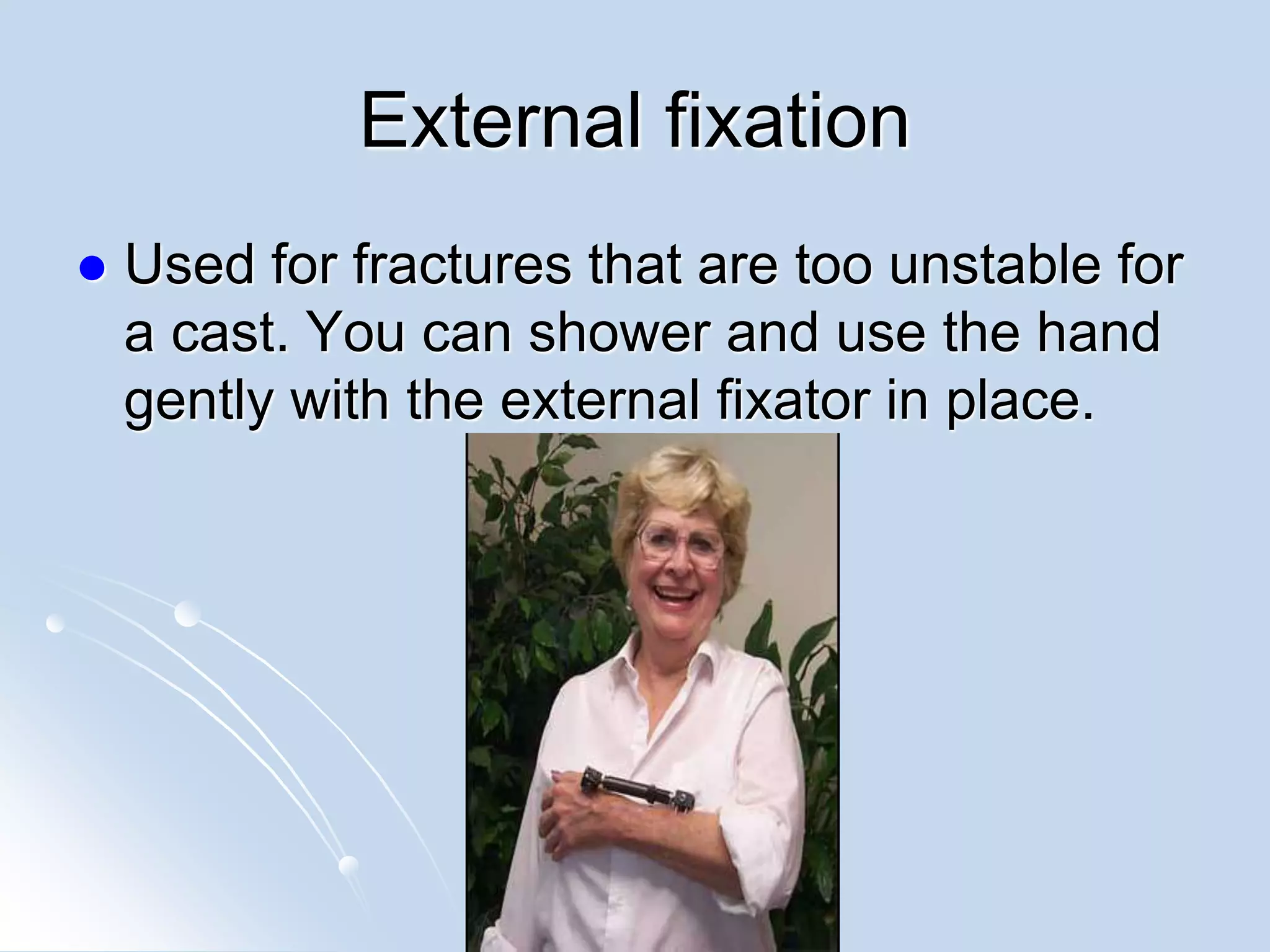 Fracture- its types and process of bone healing. | PPT