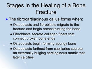 Fracture- its types and process of bone healing. | PPT