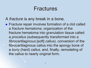 Fracture- its types and process of bone healing. | PPT
