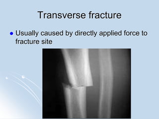 Fracture- its types and process of bone healing. | PPT