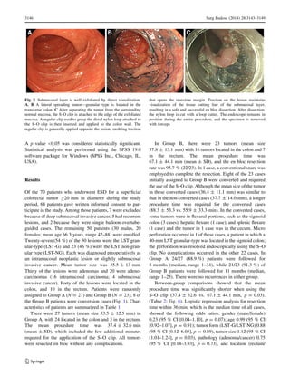 Prospective clinical trial of traction device-assisted endoscopic ...