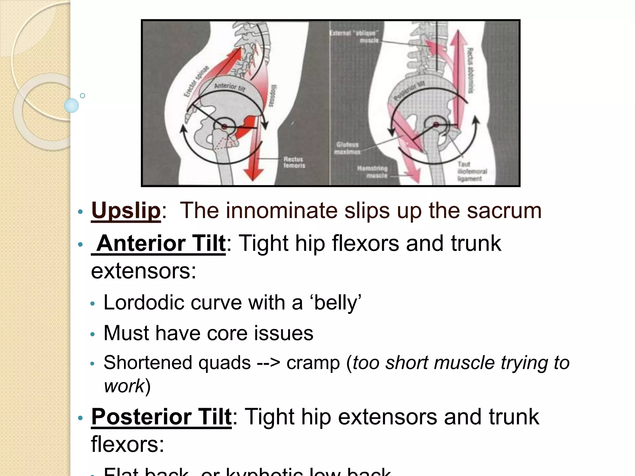 Discerning the Pelvis | PPTX