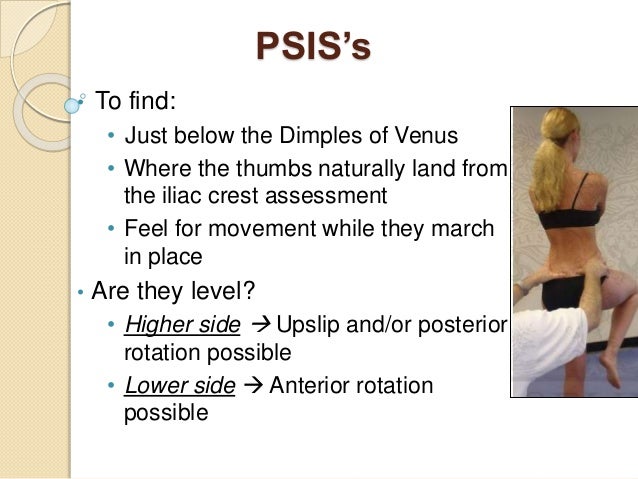 Discerning the Pelvis