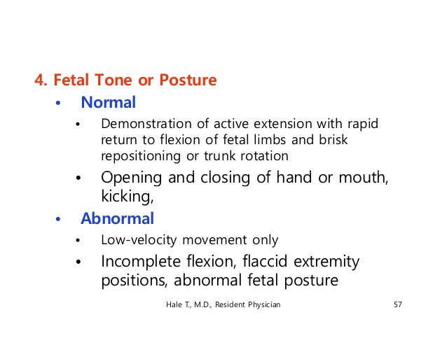 Antepartum Fetal Surveillance