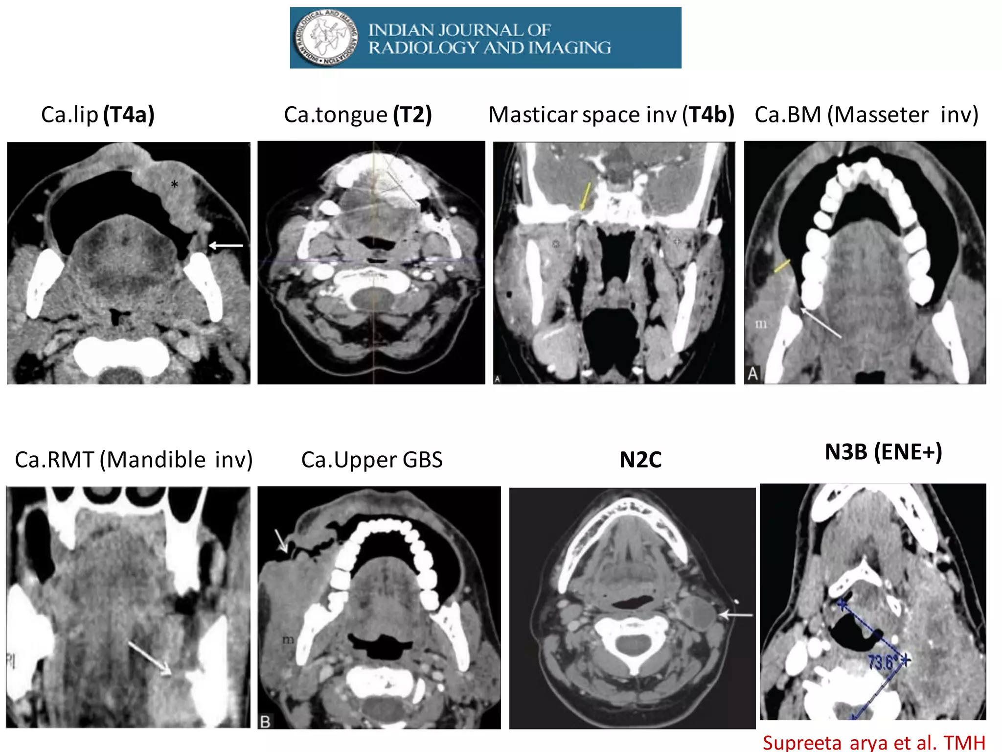 CA.ORAL CAVITY FINAL.pdf