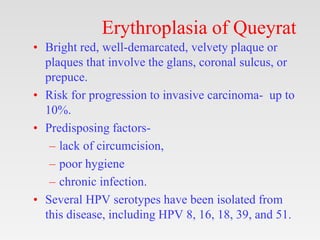 Erythroplasia Of Queyrat