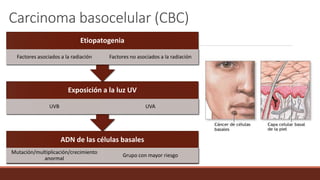 Cancer de Piel: Puntos importantes, Histologia... | PPTX