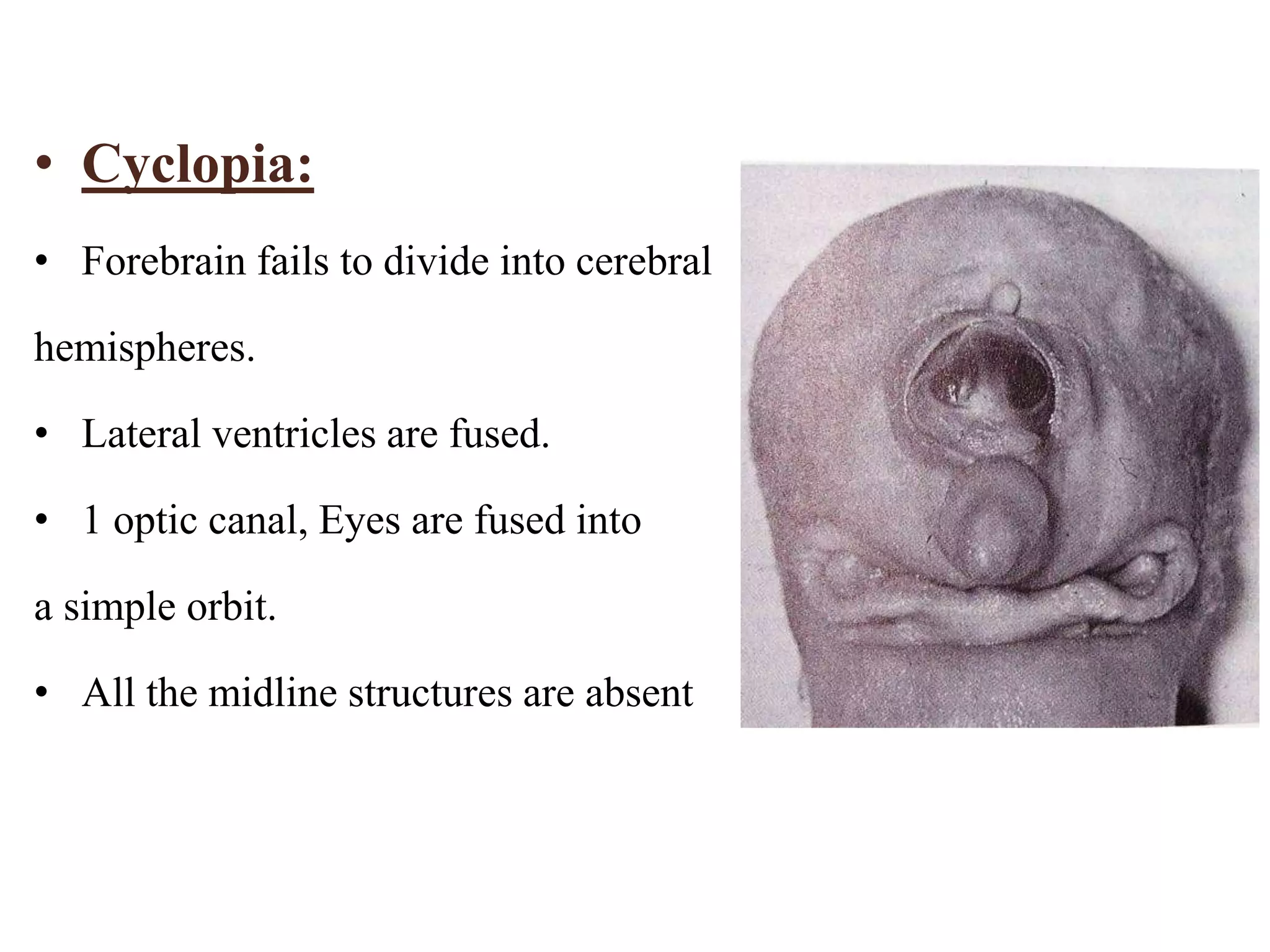 craniofacial anomalies | PPTX