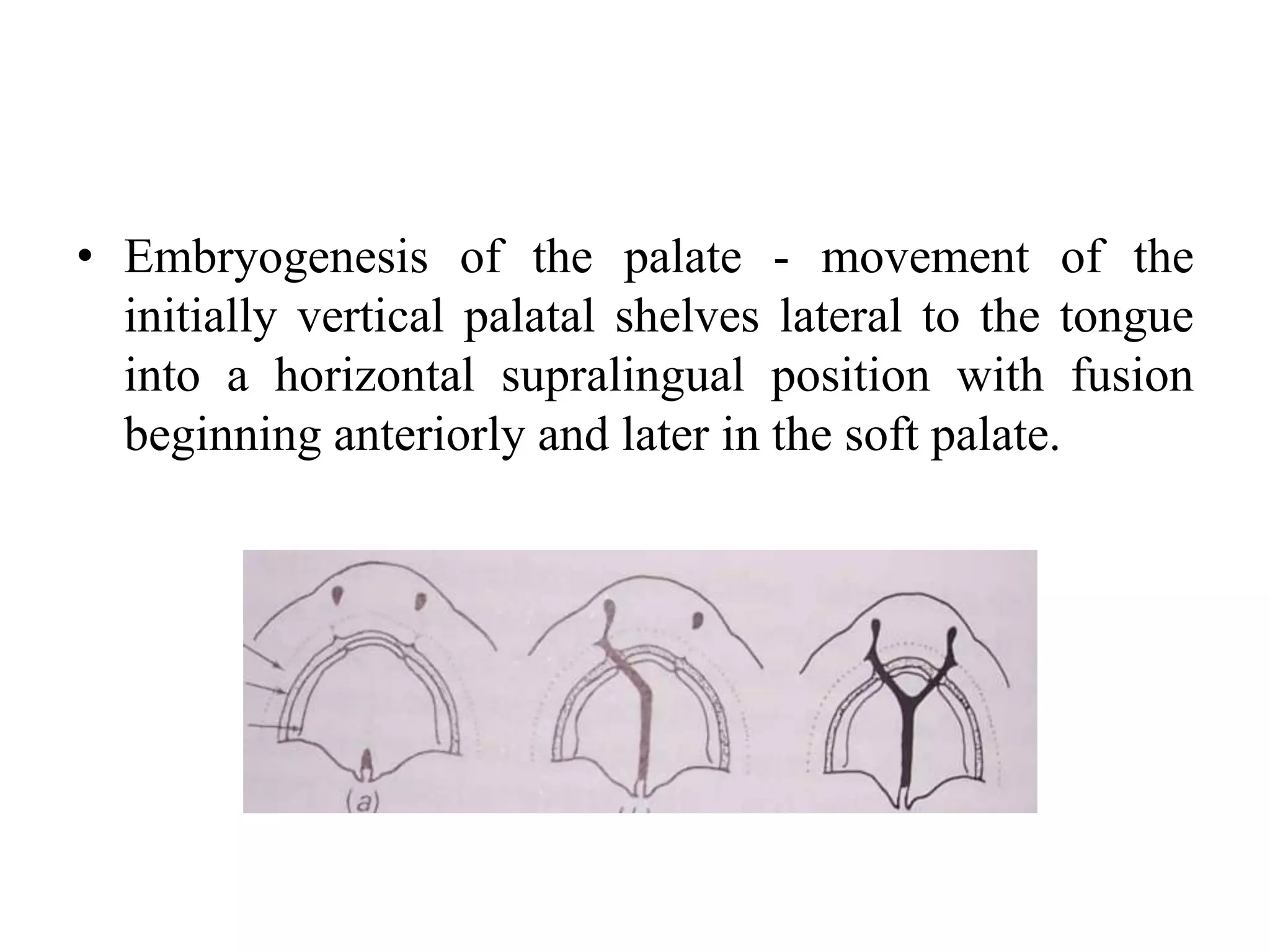 craniofacial anomalies | PPTX