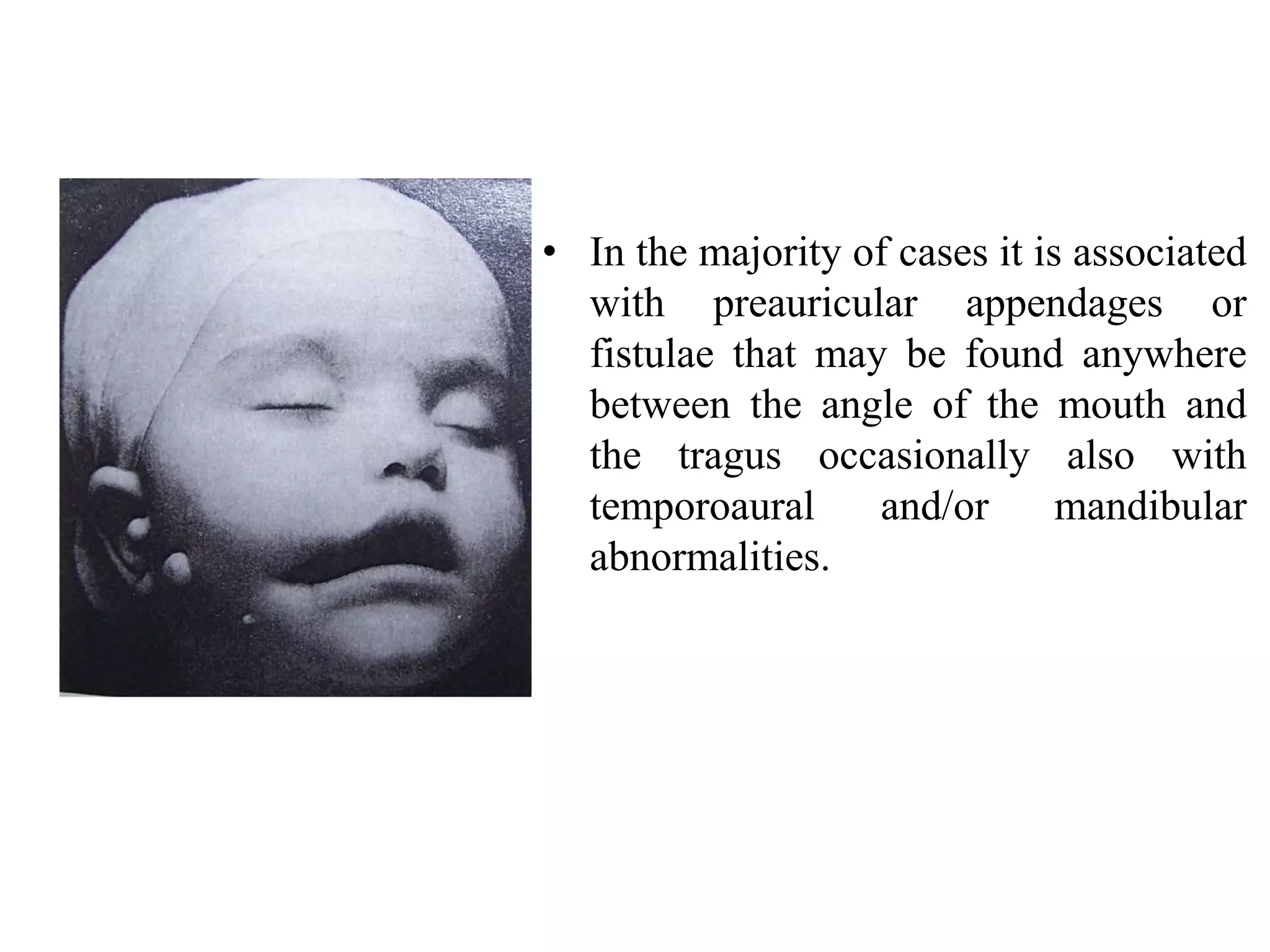 craniofacial anomalies | PPTX