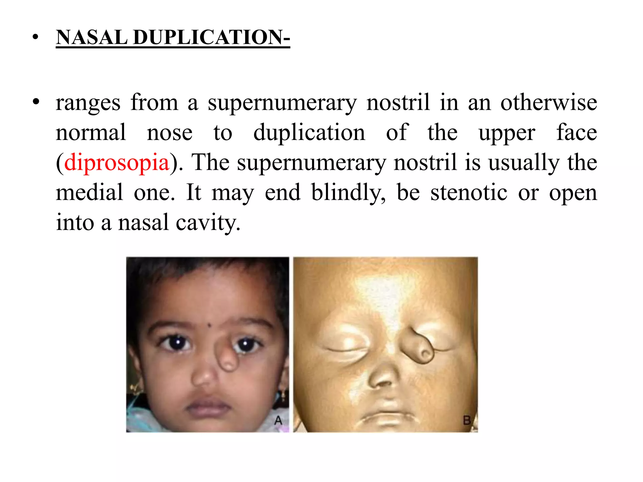 craniofacial anomalies | PPTX