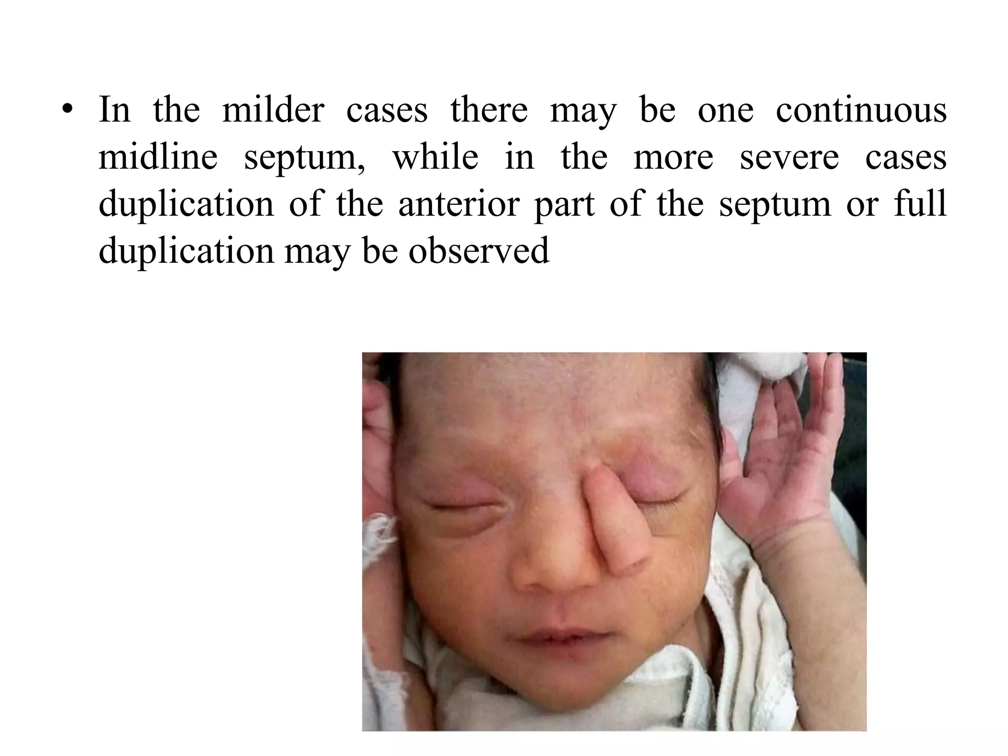 craniofacial anomalies | PPTX