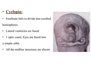 craniofacial anomalies | PPTX