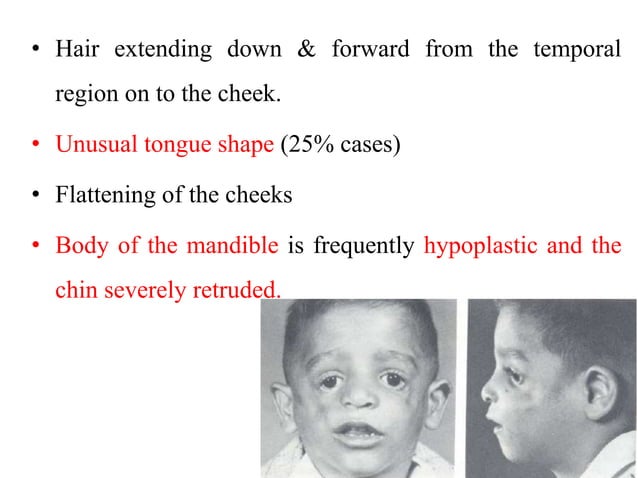 craniofacial anomalies | PPTX