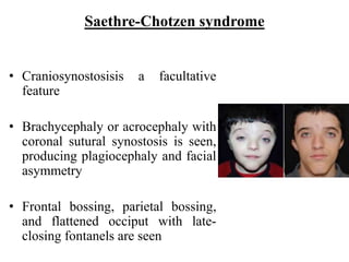 craniofacial anomalies | PPTX