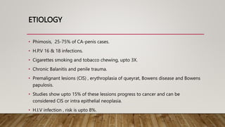 Cancer of PENIS by KUTOSI Joseph.pptx