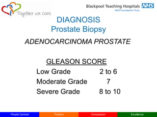 Prostate cancer Diagnosis and management | PDF