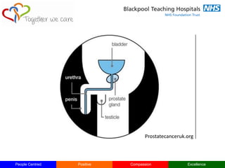 Prostate cancer Diagnosis and management | PPT