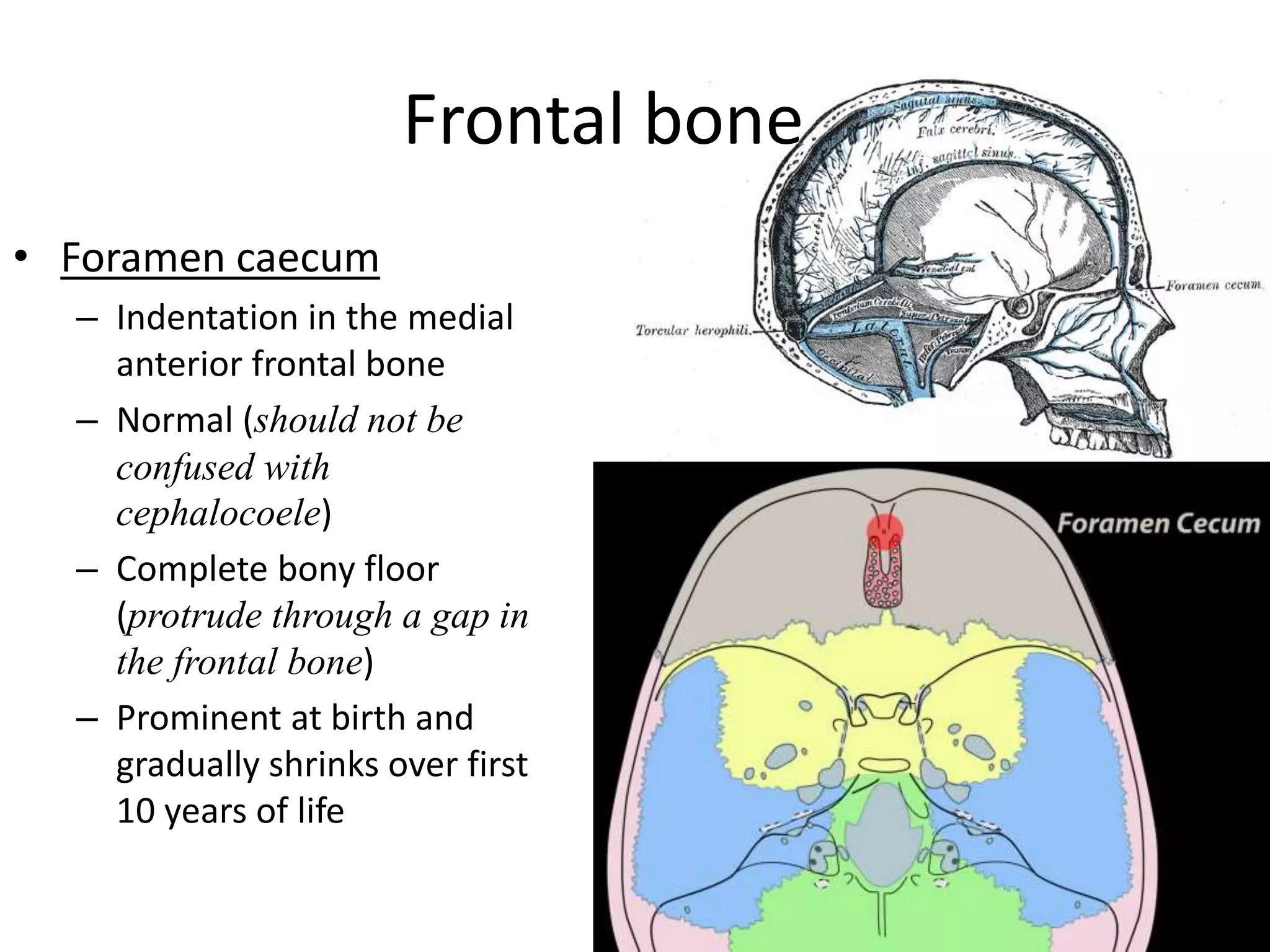Imaging in Skull base | PPTX